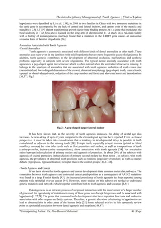The Interdisciplinary Management of Tooth Agenesis; Clinical Update | PDF