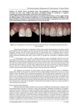 The Interdisciplinary Management of Tooth Agenesis; Clinical Update | PDF