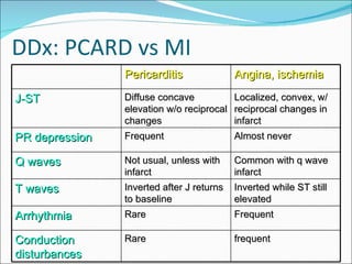 acute pericarditis | PPT