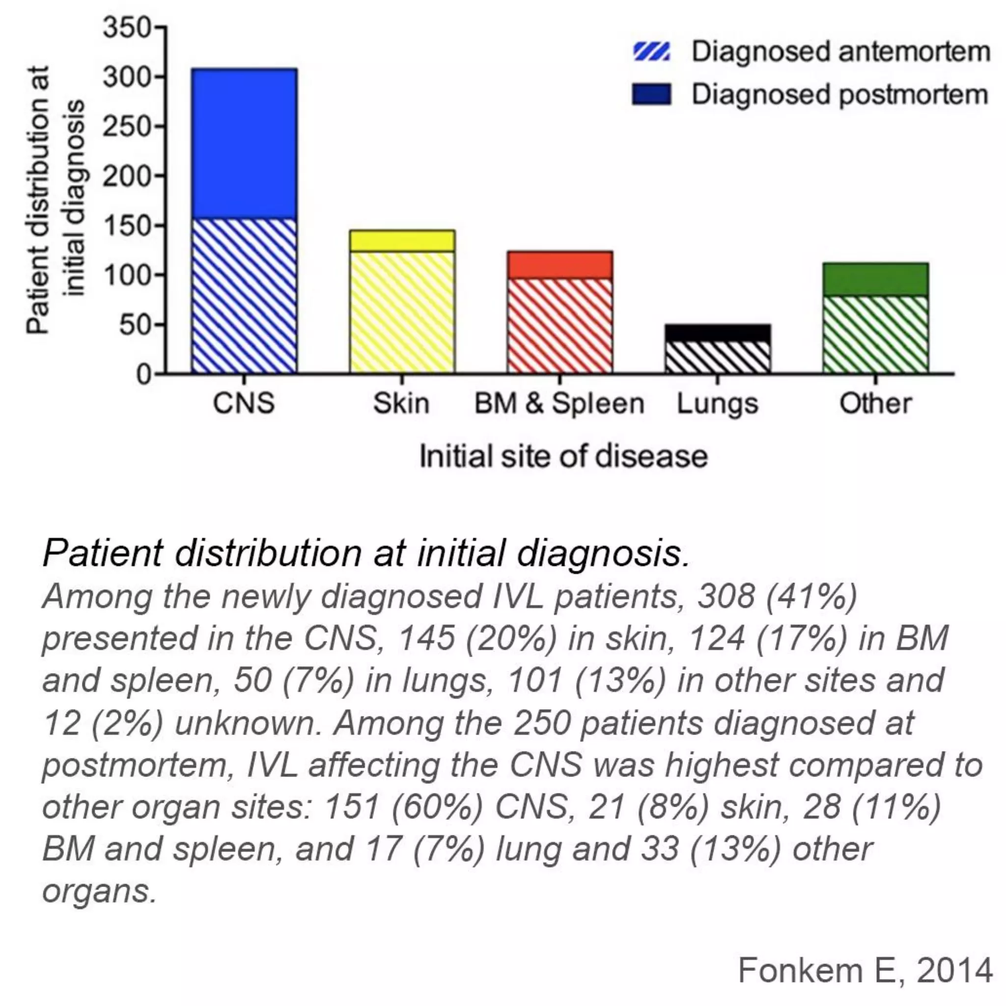 Intravascular large B-cell lymphoma (IVL) | PDF