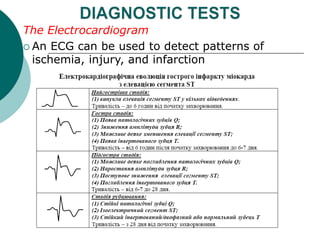 11111801_Myocardial_infarction.ppt