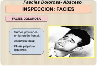Semiologia-de-Cara.ppt
