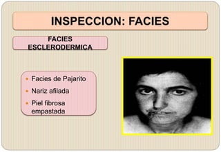 Semiologia-de-Cara.ppt