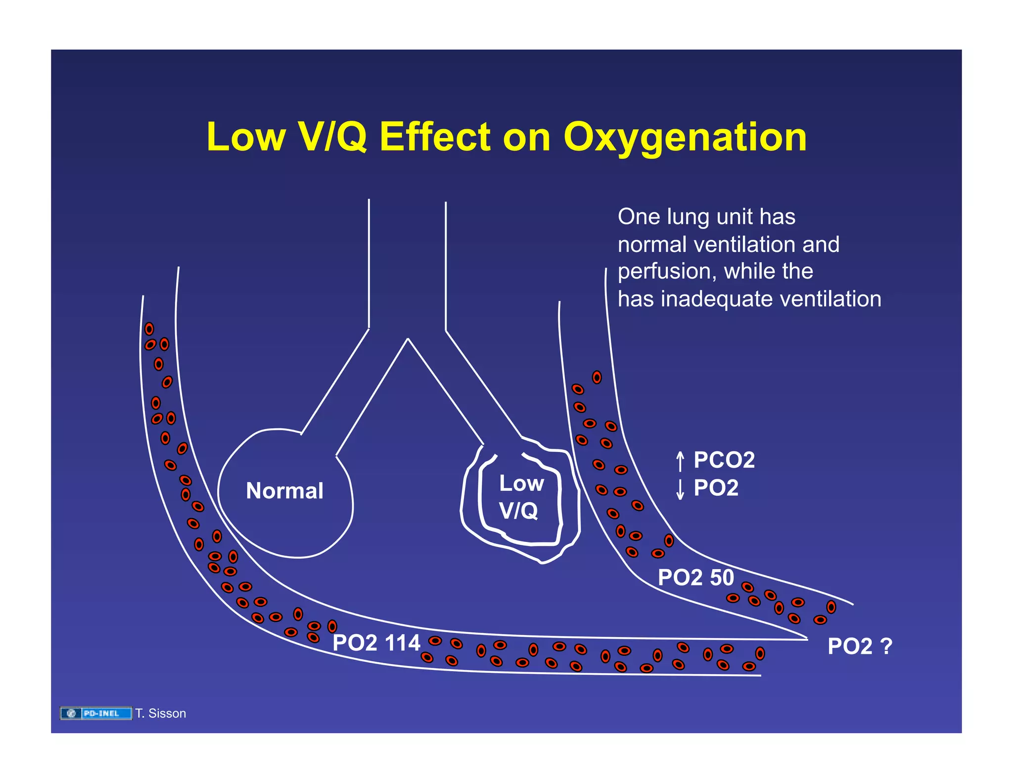11.19.08: Ventilation/Perfusion Matching | PDF