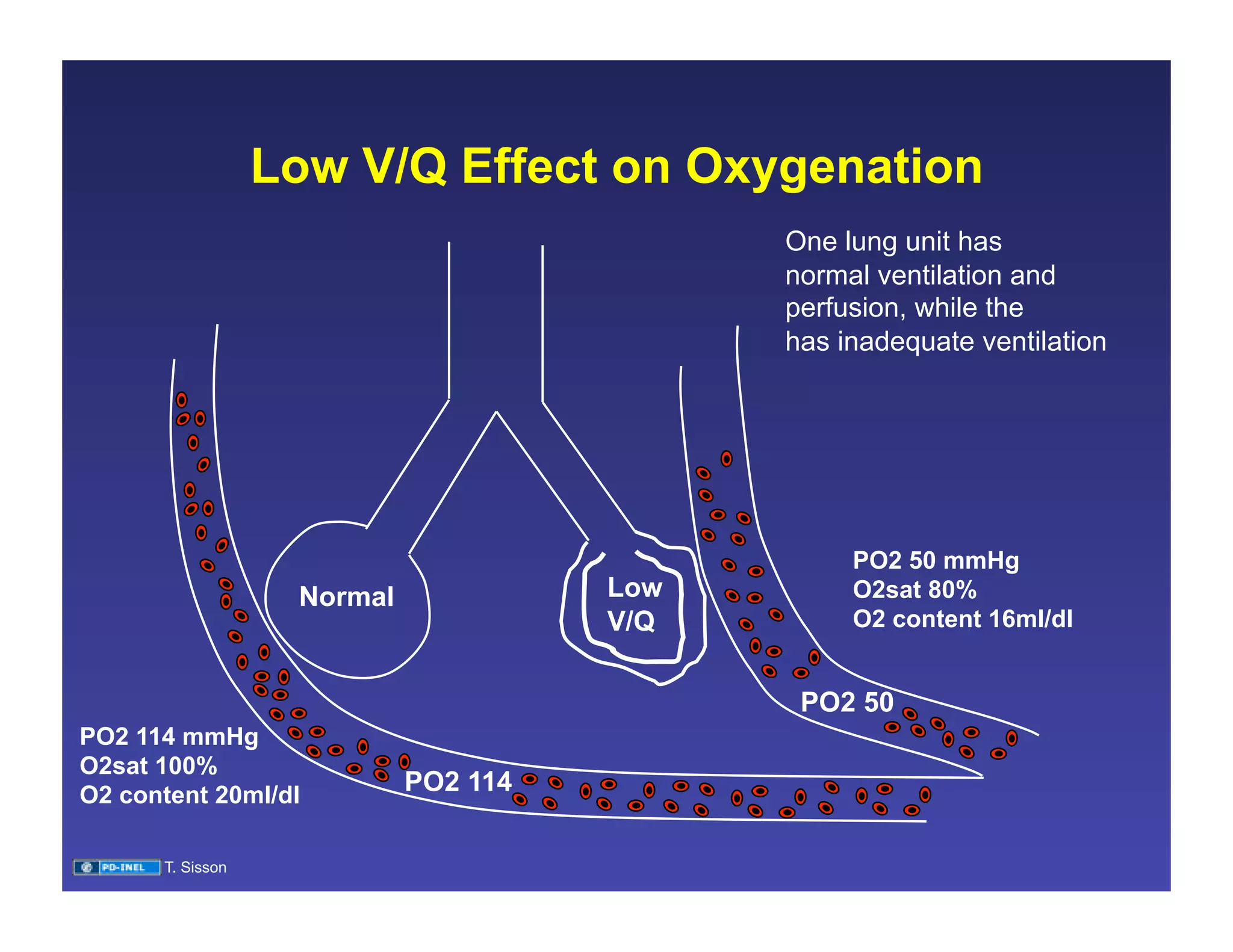 11.19.08: Ventilation/Perfusion Matching | PDF