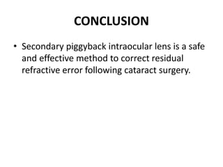 Secondary Piggyback Iol Implantation For Correction Of Residual ...