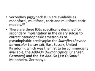 Secondary Piggyback Iol Implantation For Correction Of Residual ...