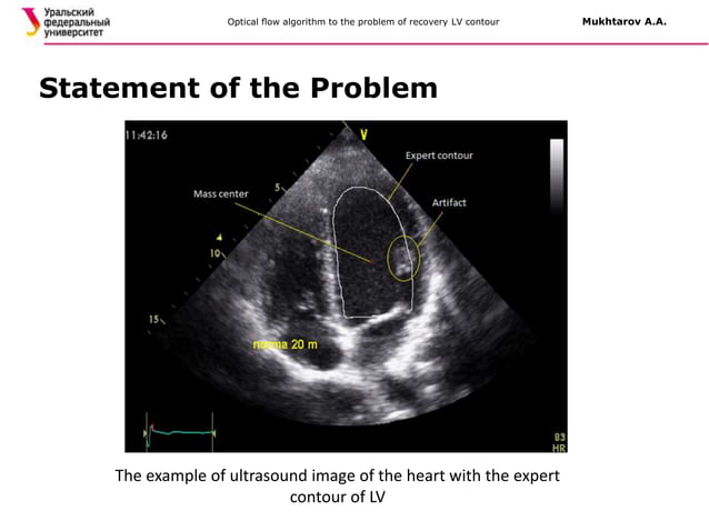 The Usage Of Optical Flow Algorithm To The Problem Of Recovery Contour