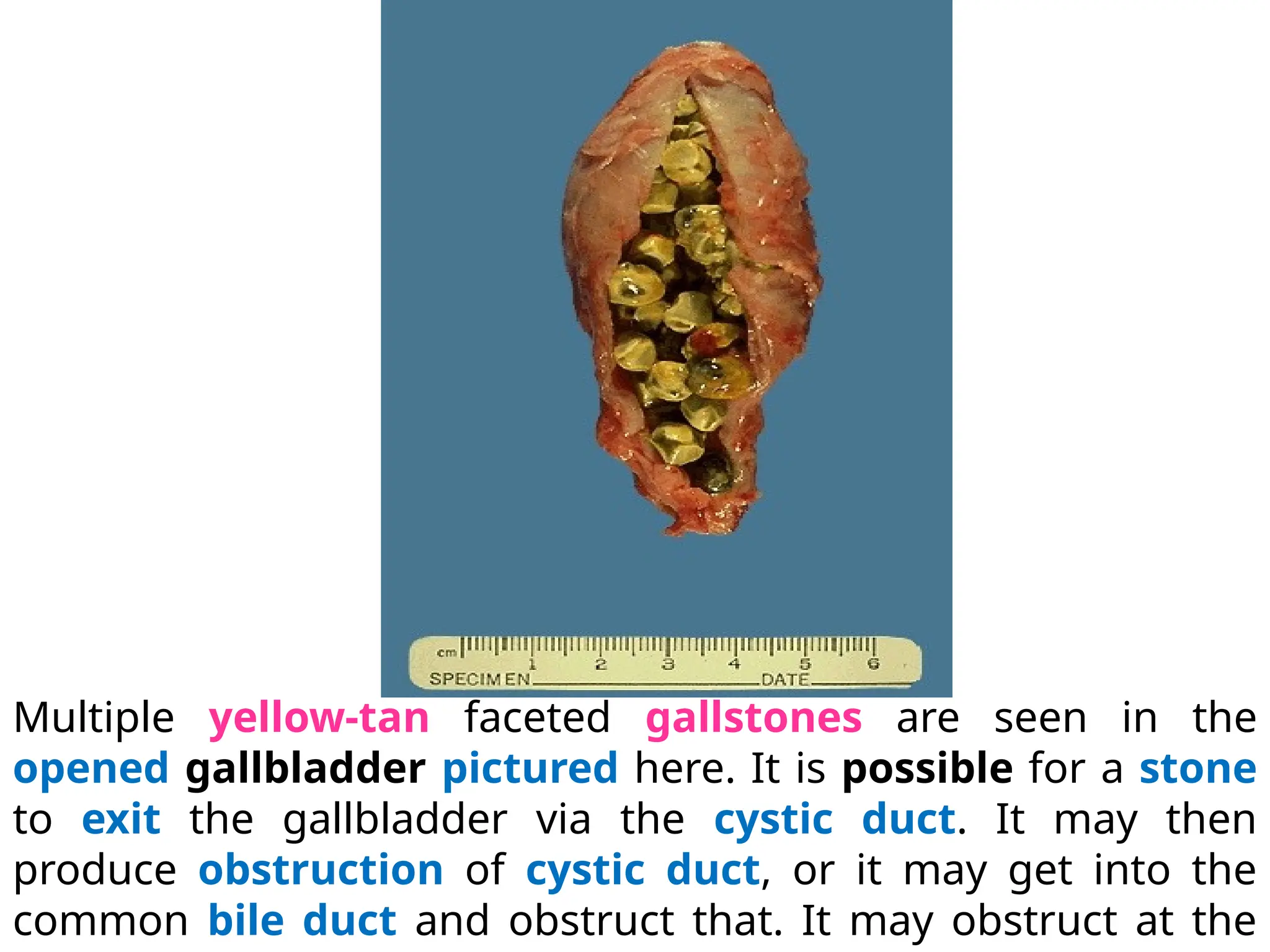 grose pathology of human organ system.pptx