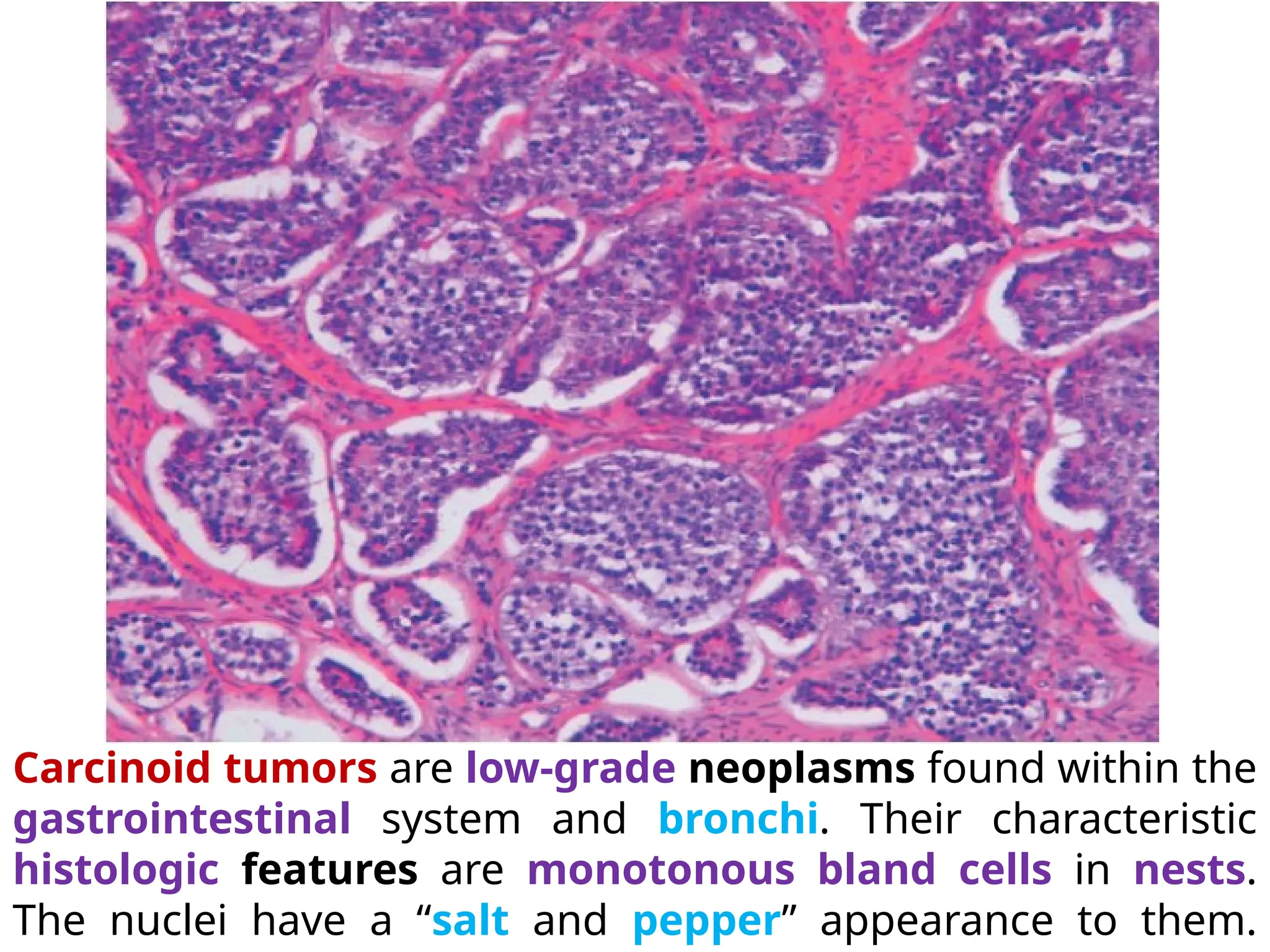 grose pathology of human organ system.pptx