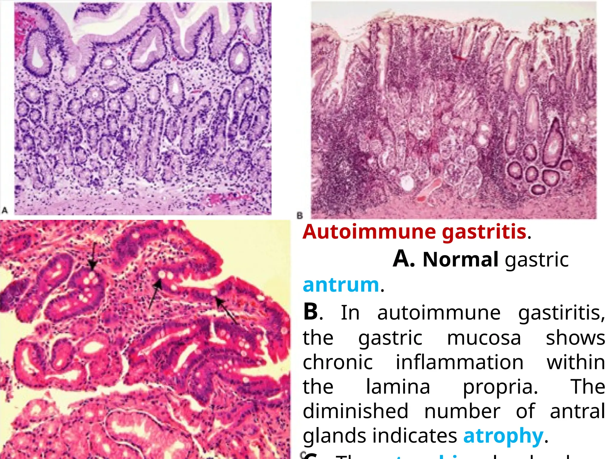 grose pathology of human organ system.pptx