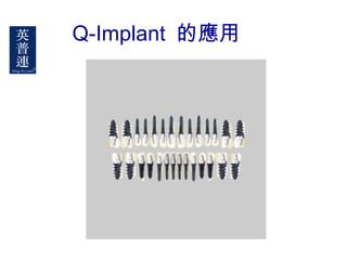 Q-Implant | PPT