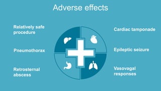 Acupoint injection.pptx