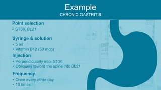 Acupoint injection.pptx | Digestive Disorders | Diseases and Conditions