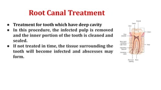 endodontic treatmet & filling root | PPTX
