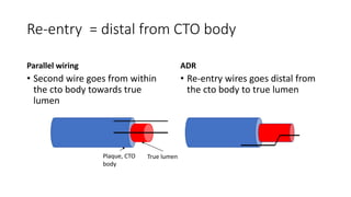 Jo Dens: Re-entry devices – essential or not? | PPTX
