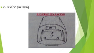 pontics in the prosthetic dentistry | PPTX