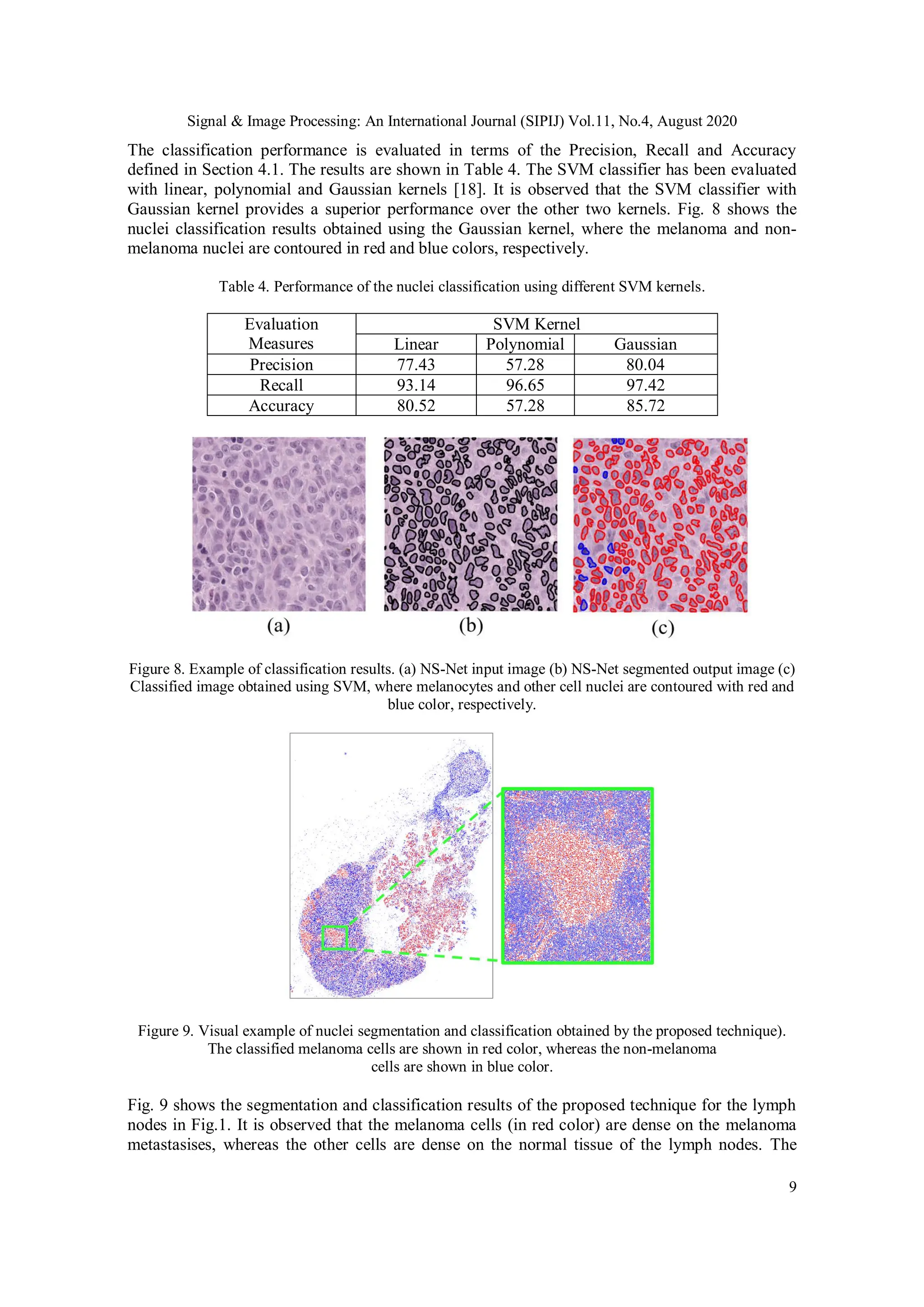 Melanoma Cell Detection in Lymph Nodes Histopathological Images using ...