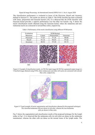 Melanoma Cell Detection in Lymph Nodes Histopathological Images using Deep Learning | PDF