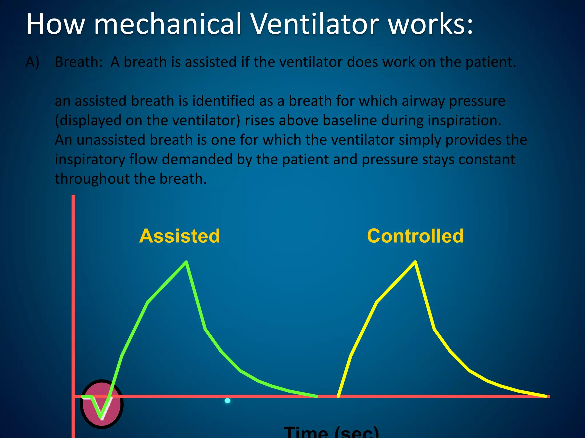 Mechanical ventilation in congenital heart defect | PPTX