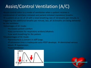 Mechanical ventilation in congenital heart defect | PPTX