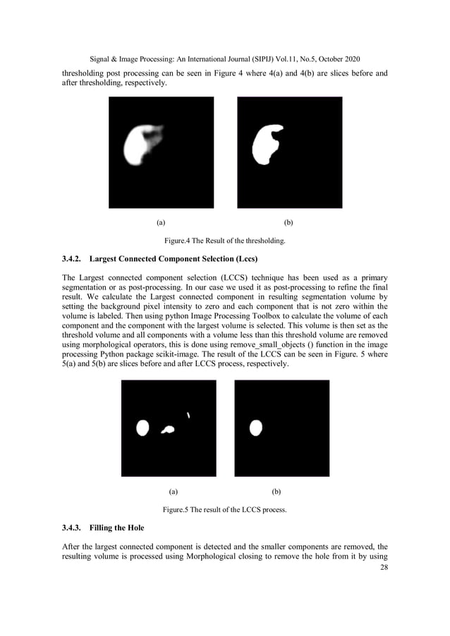 Eye Gaze Estimation Invisible and IR Spectrum for Driver Monitoring ...