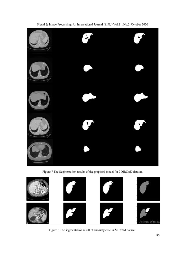 Bata-Unet: Deep Learning Model for Liver Segmentation | PDF