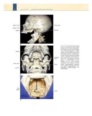 Surgical Anatomy And Techniques To The Spine Daniel H Kim Jeffrey Henn ...