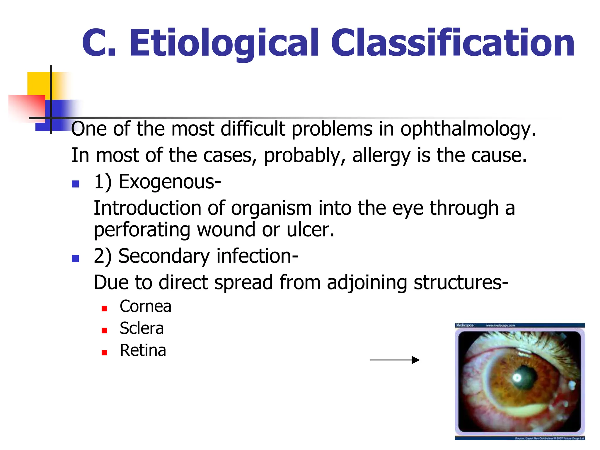 1167_Anterior-Uveitis.ppt (inflammation of iris, cilliary body, choroid ...