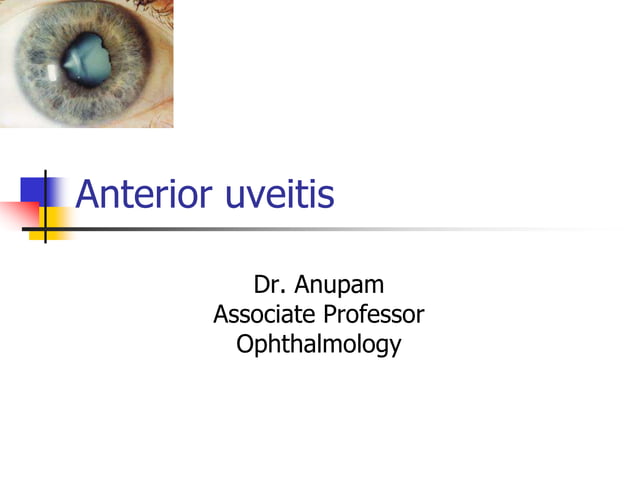 1167_Anterior-Uveitis.ppt (inflammation of iris, cilliary body, choroid ...