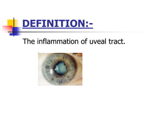 1167_Anterior-Uveitis.ppt (inflammation of iris, cilliary body, choroid ...