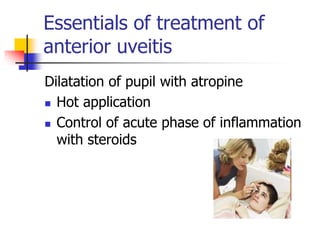 1167_Anterior-Uveitis.ppt (inflammation of iris, cilliary body, choroid ...