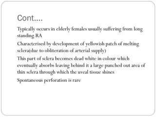 1168_Episcleritis-and-Scleritis.pdf fir jrs | PPT