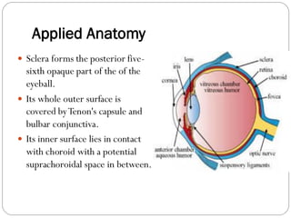 1168_Episcleritis-and-Scleritis.pdf fir jrs | PPT