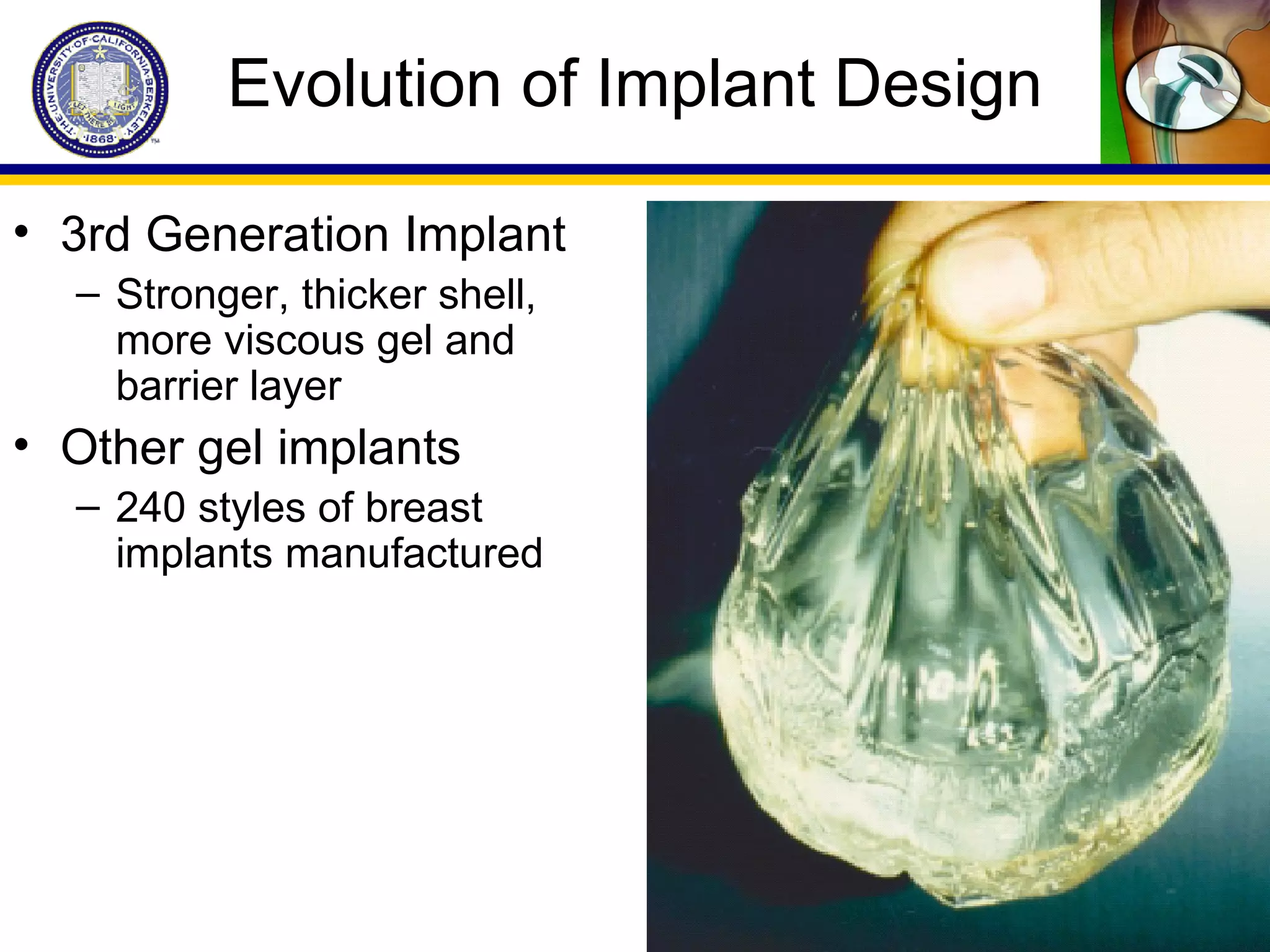 Breast Implants | PPT