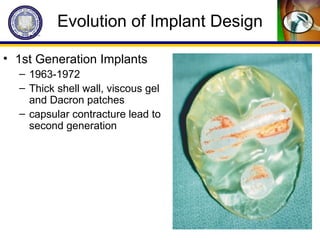 Breast Implants | PPT