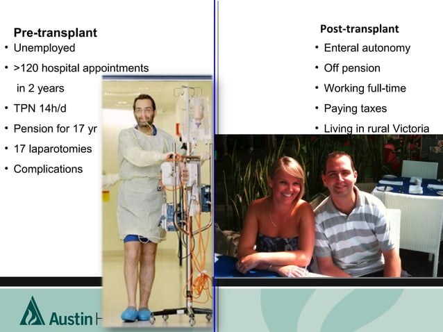 Intestinal Transplant: Overview and Australian Perspective | PPT