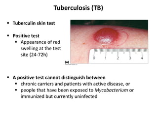 11 bio265 disease of respiratory system instructor dr di bonaventura | PPT