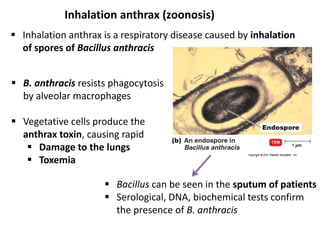 11 bio265 disease of respiratory system instructor dr di bonaventura | PPT