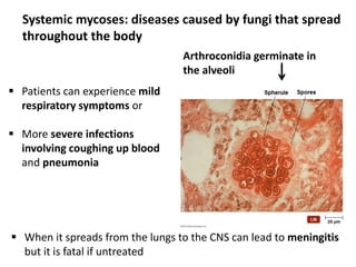 11 bio265 disease of respiratory system instructor dr di bonaventura | PDF