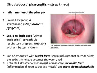 11 bio265 disease of respiratory system instructor dr di bonaventura | PPT