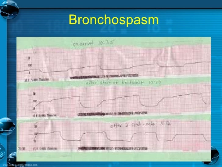 11 capnography