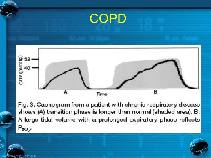 11 capnography