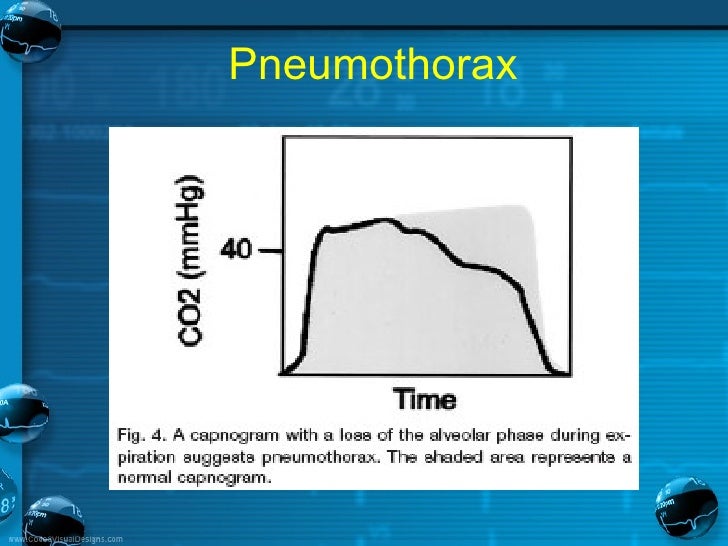 11 capnography