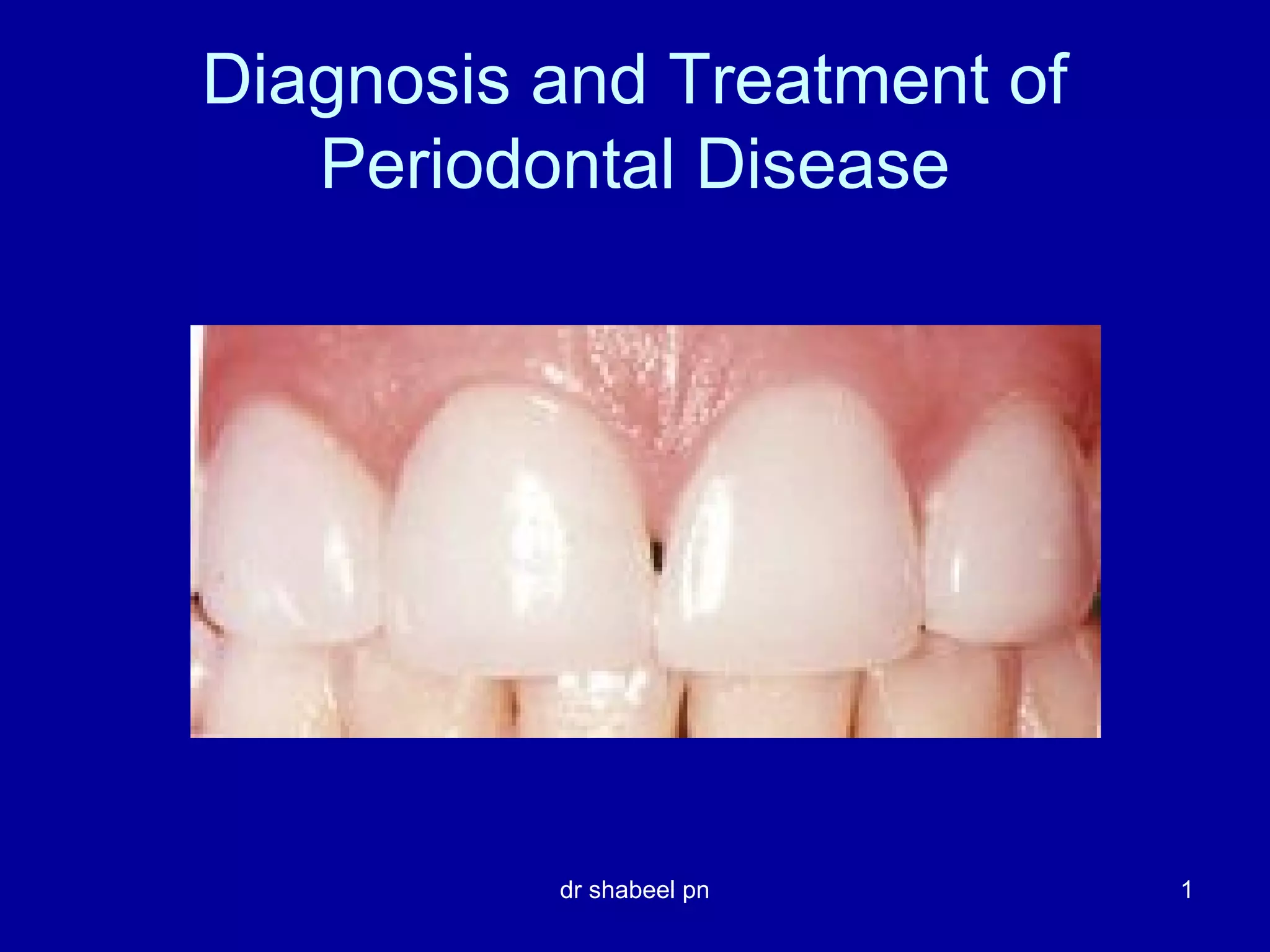 11diagnosis and treatment_of_periodontal_disease dissan | ODP