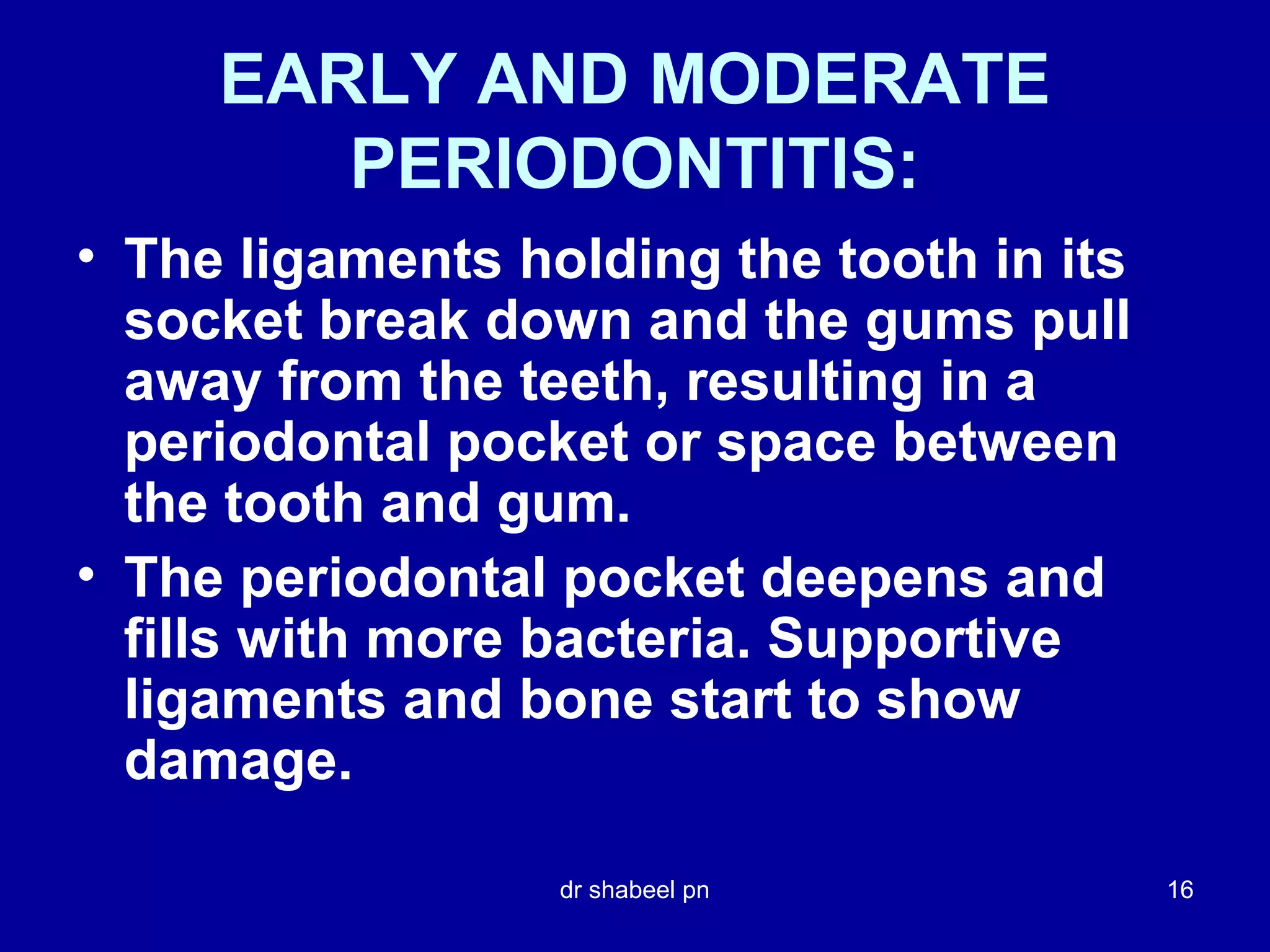11diagnosis and treatment_of_periodontal_disease dissan | ODP