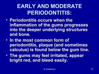 11diagnosis and treatment_of_periodontal_disease dissan | ODP