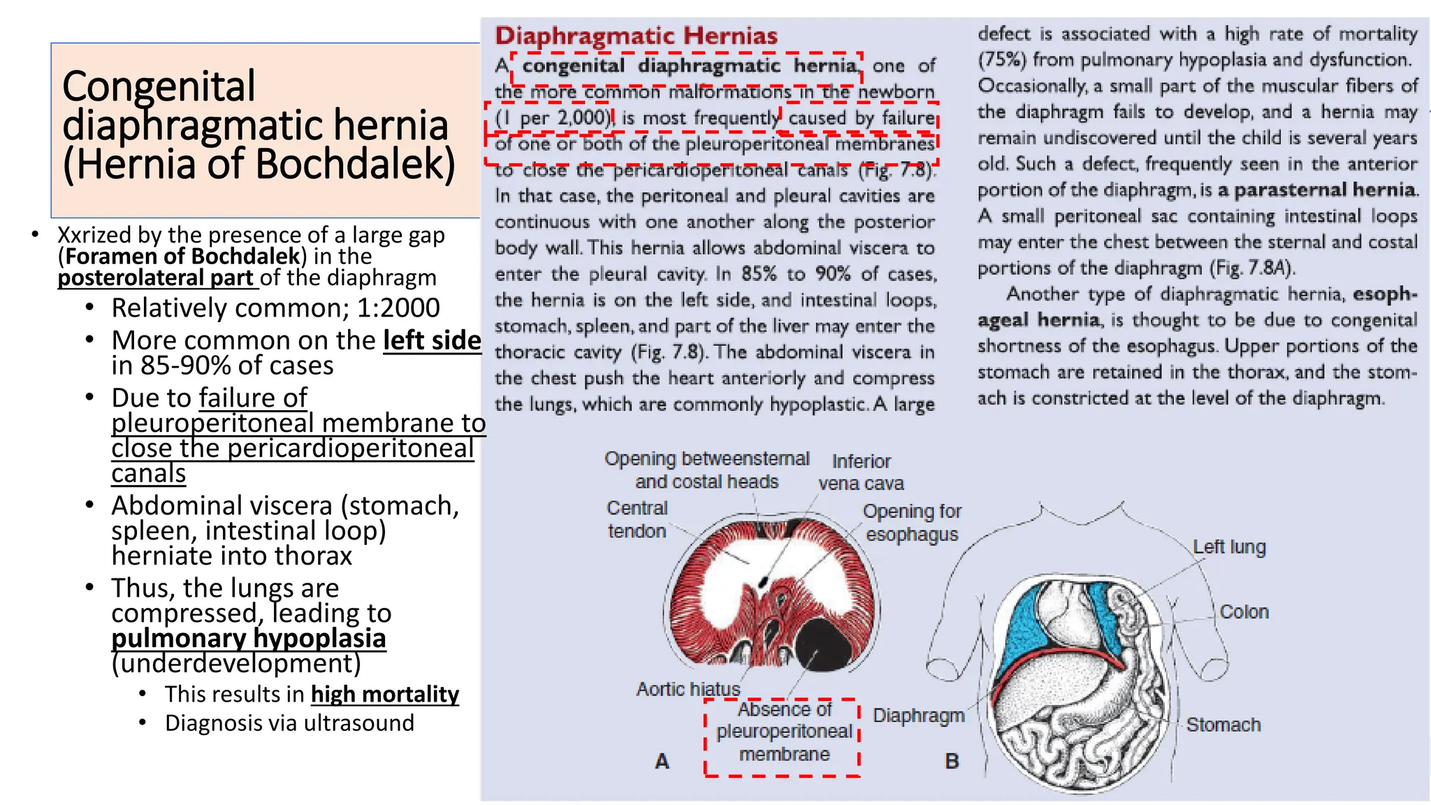 respiratorysy11_Dvt of the Diaphragm.pdf