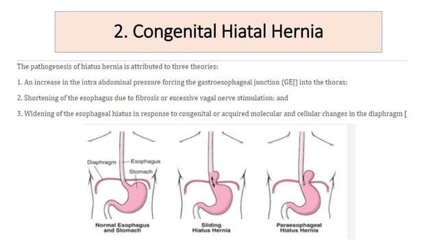 respiratorysy11_Dvt of the Diaphragm.pdf