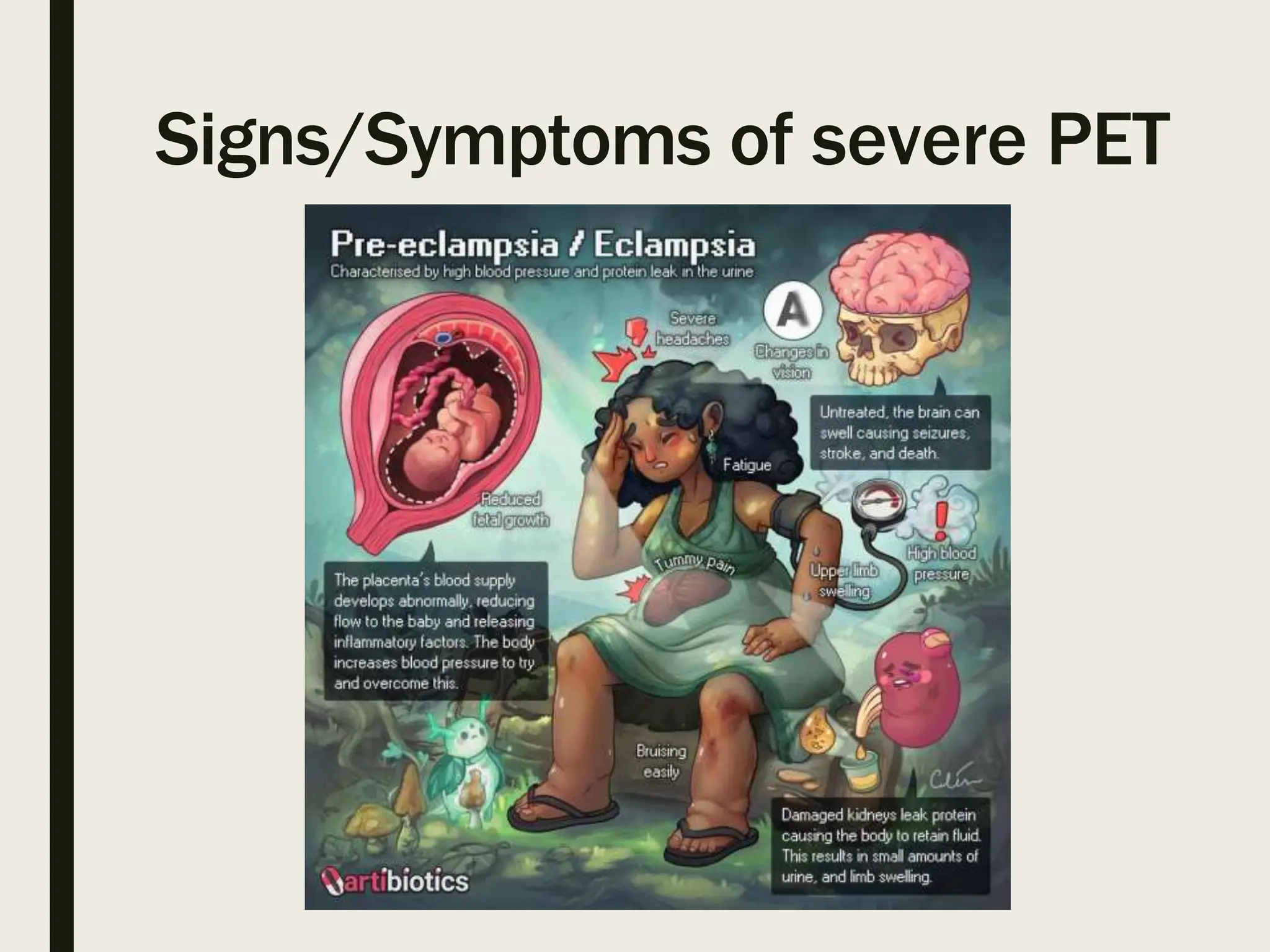 11_Eclampsia and preeclampsia real.pptxf | PPT